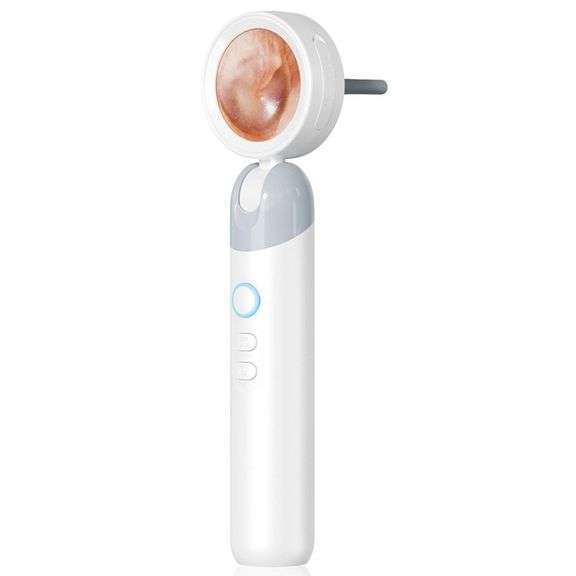 Smart Detector with Screen Ear Cleaning Endoscope – 1080P HD Lens Q10 ...